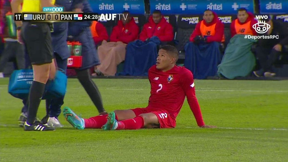 Iván Anderson sufrió lesión en el partido contra Uruguay