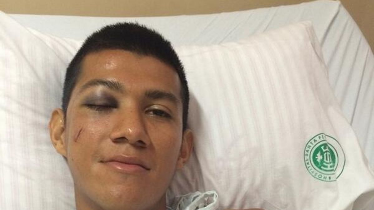 Edward Benítez del Chorrillo será operado por fractura en el pómulo