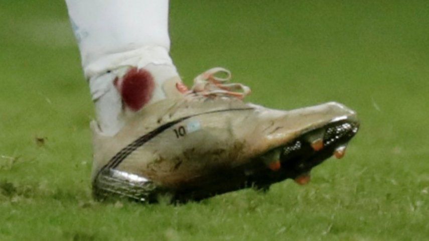 Copa América: TREMENDA patada a Messi, así quedó su tobillo con sangre